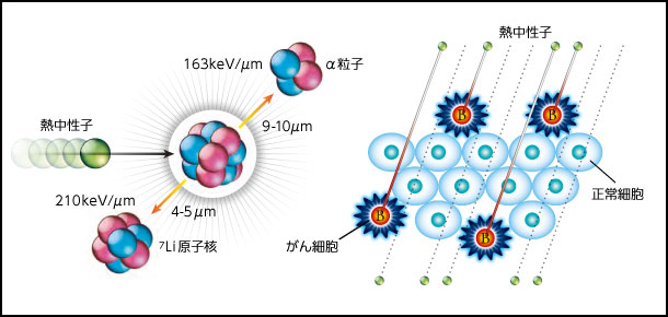 什么是BNCT？日本新一代癌症治疗技能硼种子俘获治疗-厚朴方舟